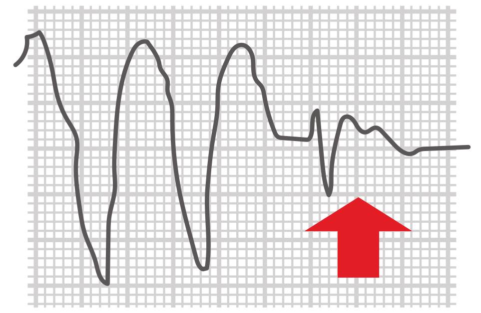 PALS : Tachycardia - Recognize