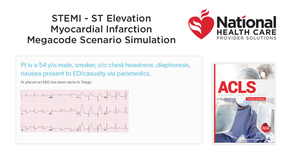 STEMI Megacode Scenario Simulation