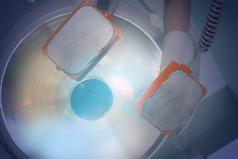 Synchronized Cardioversion: A Step-by-Step Guide for Rescuers