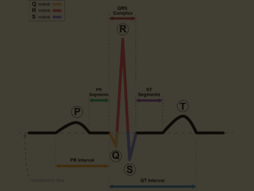 PQRST Wave Explained: ECG Interpretation Made Easy
